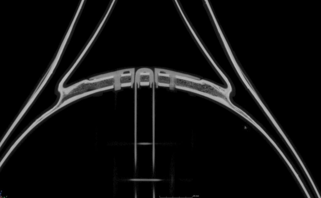 The Scan of the Month July – Wimbledon and the engineering inside ...